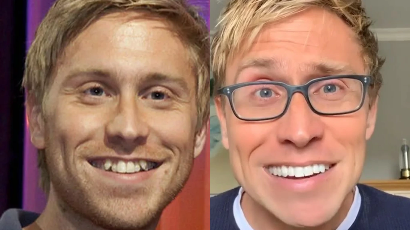 Transformarea dinților lui Russell Howard: Înainte și după | Lema ...