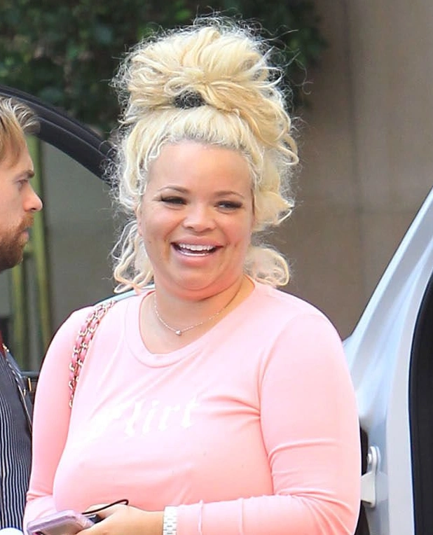 Nowe zęby Trishy Paytas - Przed i Po