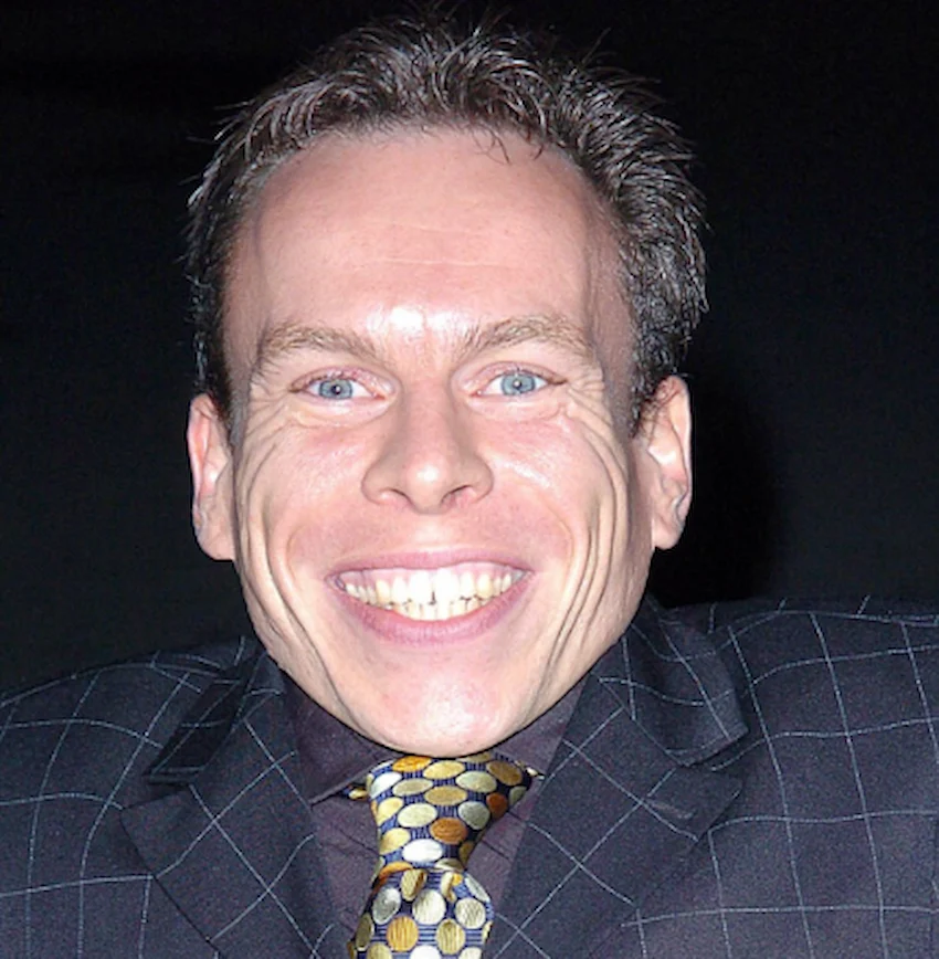 🎭 La transformación de la sonrisa de Warwick Davis