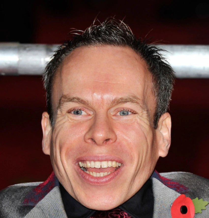 🎭 Transformacja Uśmiechu Warwicka Davisa: Idealne Zęby