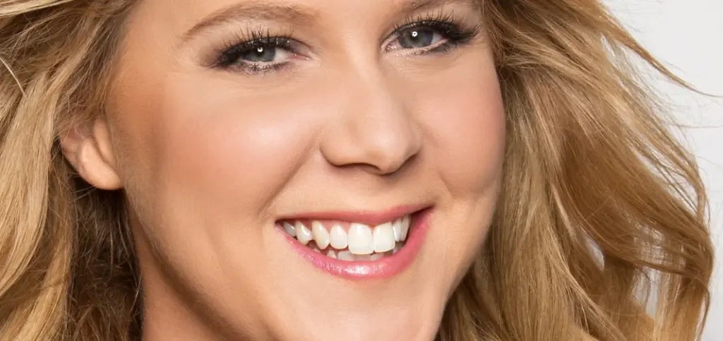 Amy Schumer Smile Evolution: Teeth Before and After | LEMA