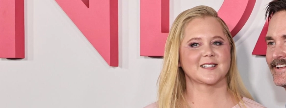 Amy Schumer Smile Evolution: Teeth Before and After | LEMA