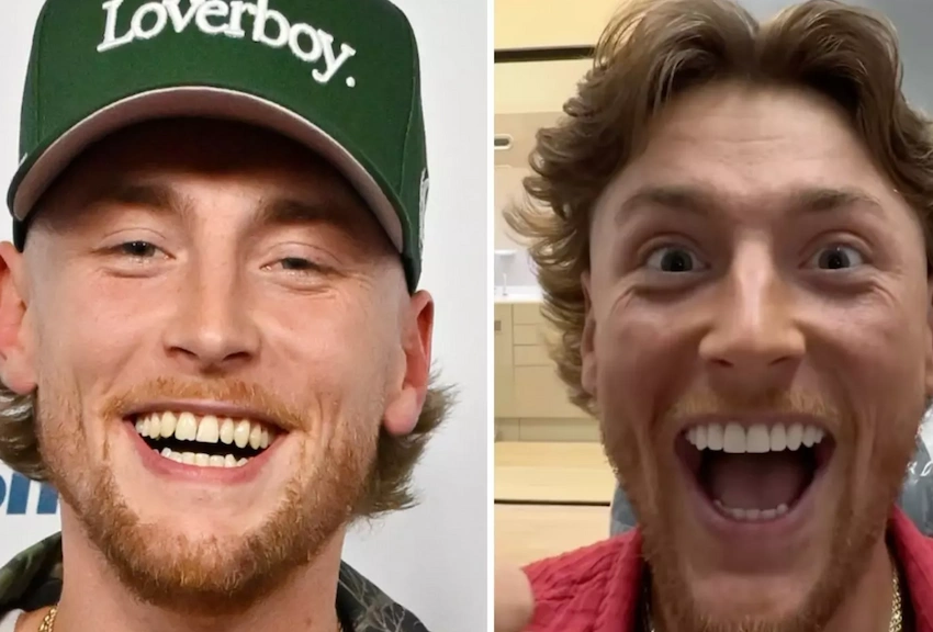 Zâmbetul de Hollywood al lui Bailey Zimmerman: Înainte și după | Lema ...