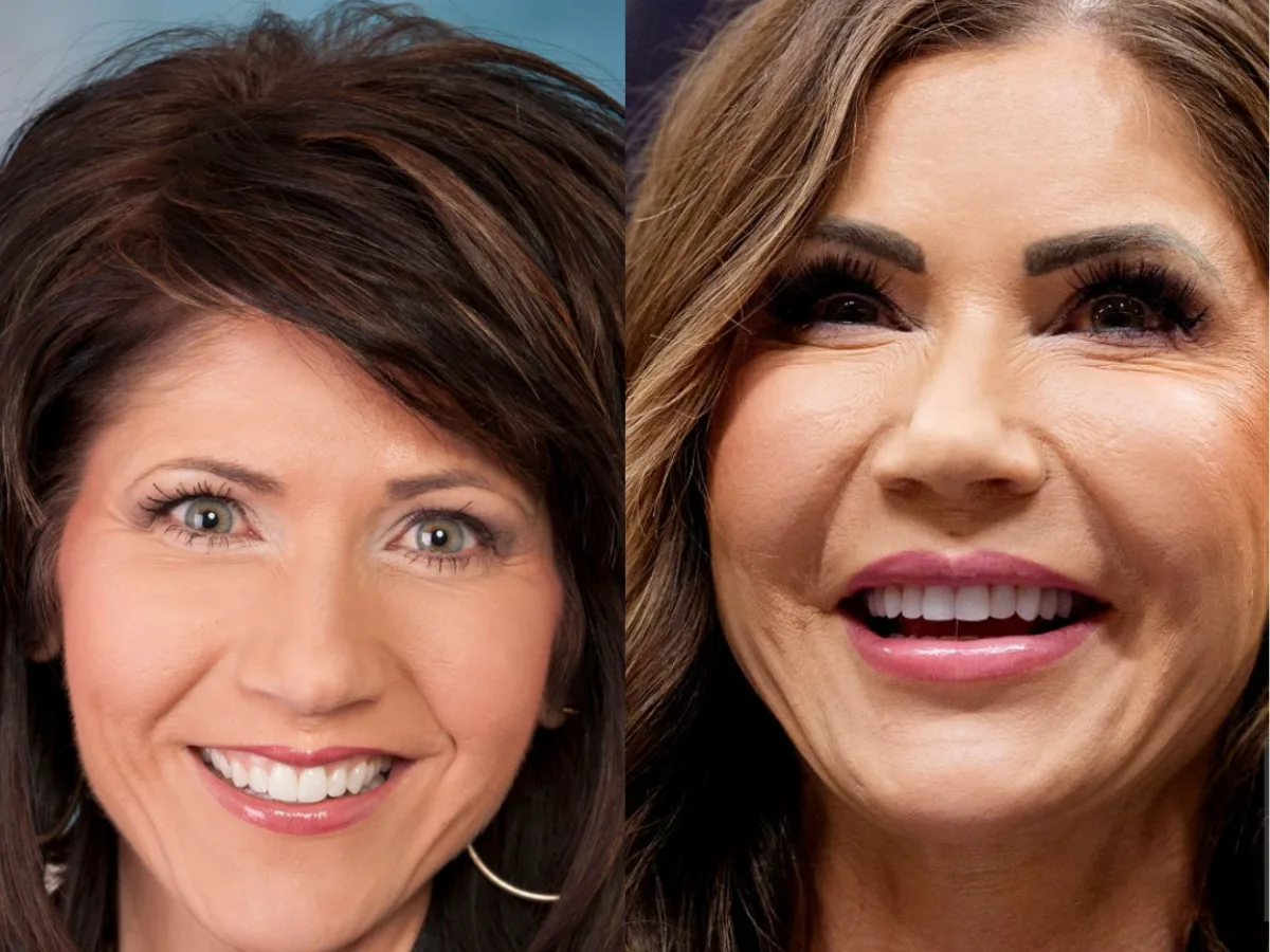 Before And After Pictures Of Kristi Noem [2026]