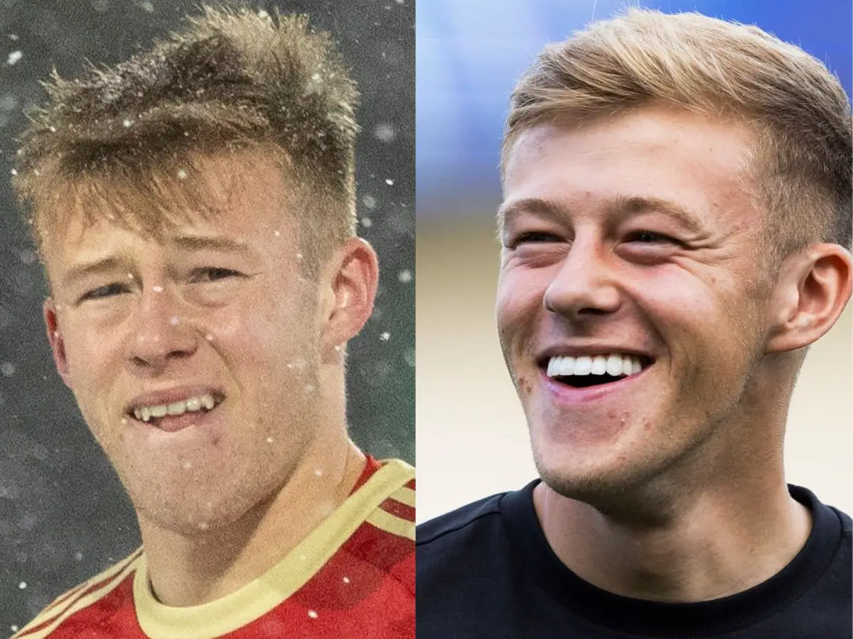 تحول أسنان كونور بارون: رحلة الابتسامة الكاملة | Lema Dental Clinic