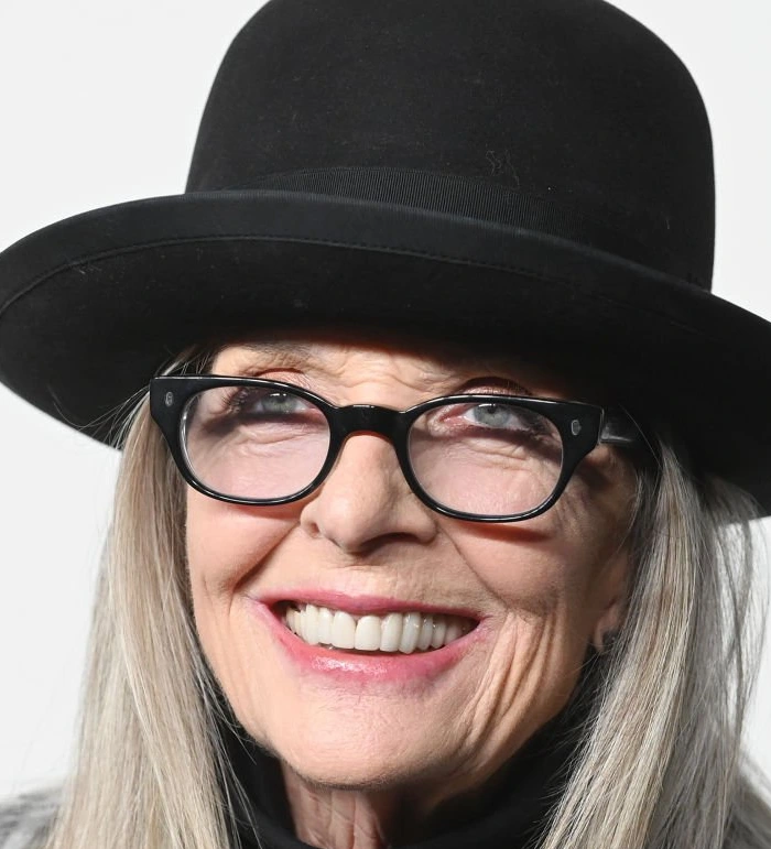 Transformación de los dientes de Diane Keaton | Lema Dental Clinic