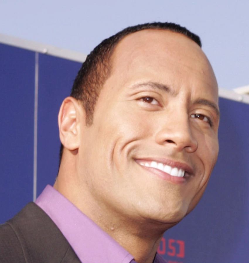 La trayectoria de transformación dental de Dwayne Johnson | Lema Dental ...