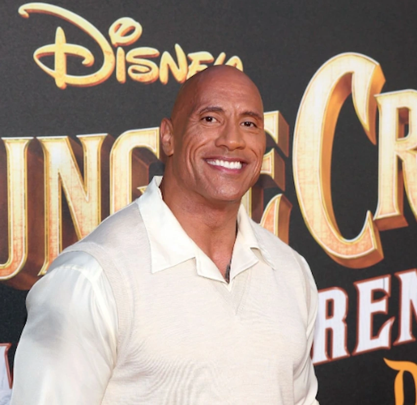 Il percorso di trasformazione dentale di Dwayne Johnson | Lema Dental ...