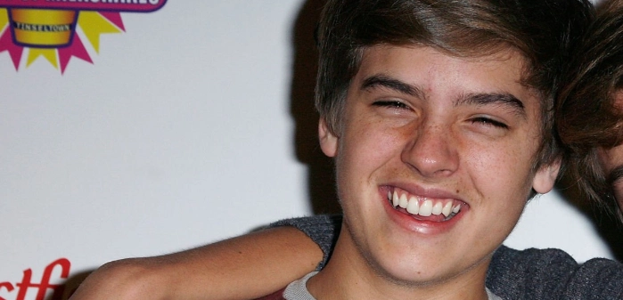 Dylan Sprouse Zobiņa (Vecā/Jaunā): Pirms un pēc