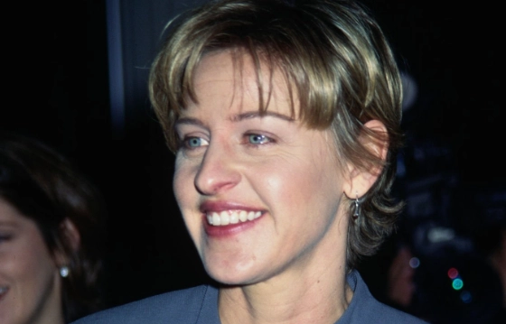 Ellen DeGeneres' Dantų Pokytis: Prieš ir Po