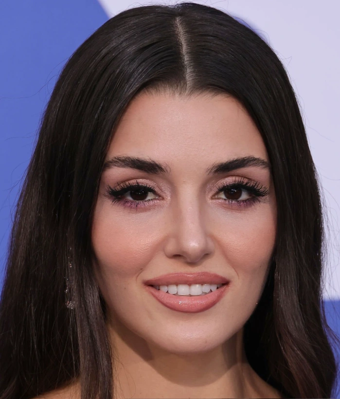 Transformacja zębów Hande Erçel - przed i po