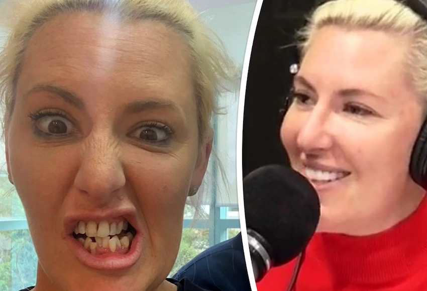 Jess Eva Teeth (Old/New): Before and Afters | LEMA
