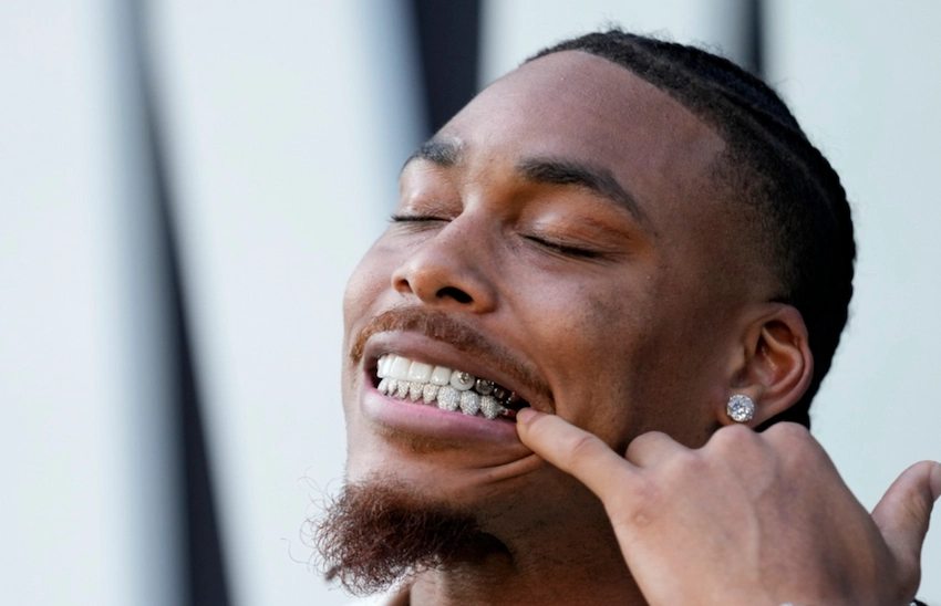 Джастін Джефферсон із діамантовими зубами: до та після