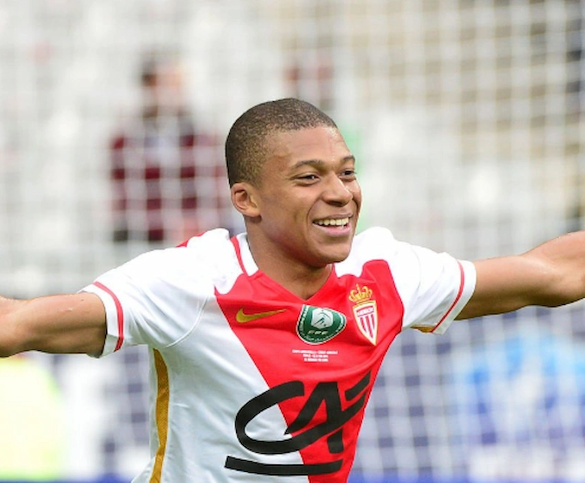 Dientes de Kylian Mbappé (Antiguos/Nuevos): Antes y Después | Lema ...
