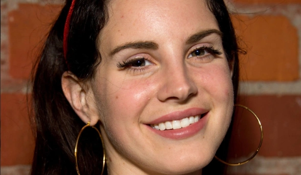 Transformation dentaire de Lana Del Rey – Avant et après | Lema Dental ...
