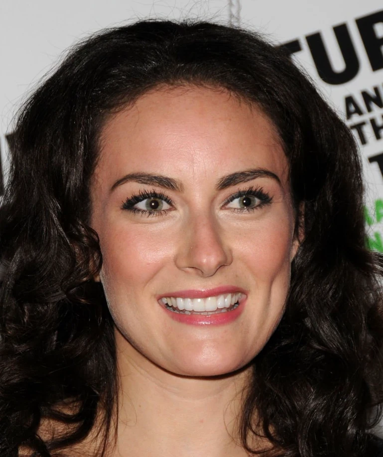 Laura Benanti's Teeth Transformation - Before and After | LEMA