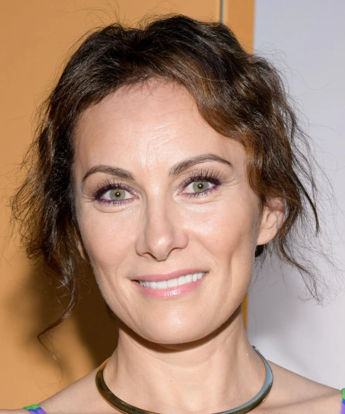 Laura Benanti's Teeth Transformation - Before and After | LEMA