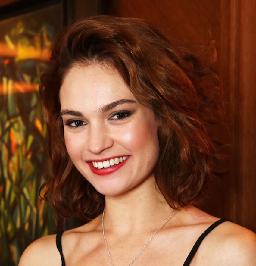 Lily James' Teeth (Old/New): Before and Afters | LEMA