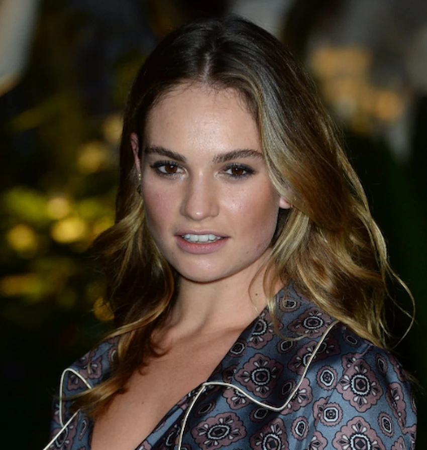 Lily James' Tanden (Oud/Nieuw): Voor en Na