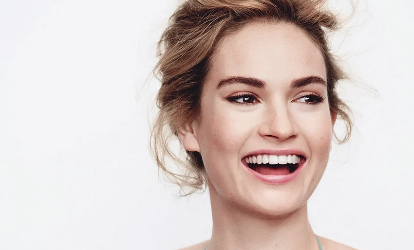 Lily James' Teeth (Old/New): Before and Afters | LEMA