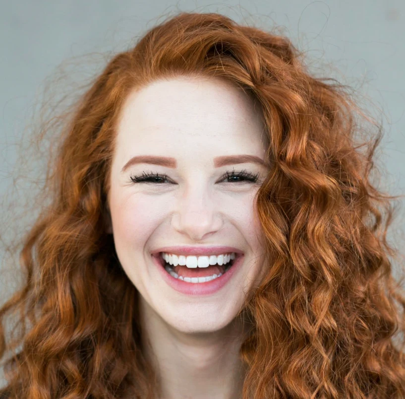 Madelaine Petsch’s Teeth Transformation - Before and After | LEMA