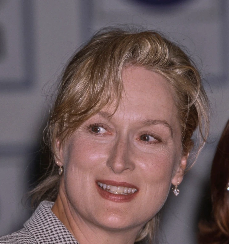 Oscar-Winning Actress Meryl Streep's Teeth Transformation | LEMA