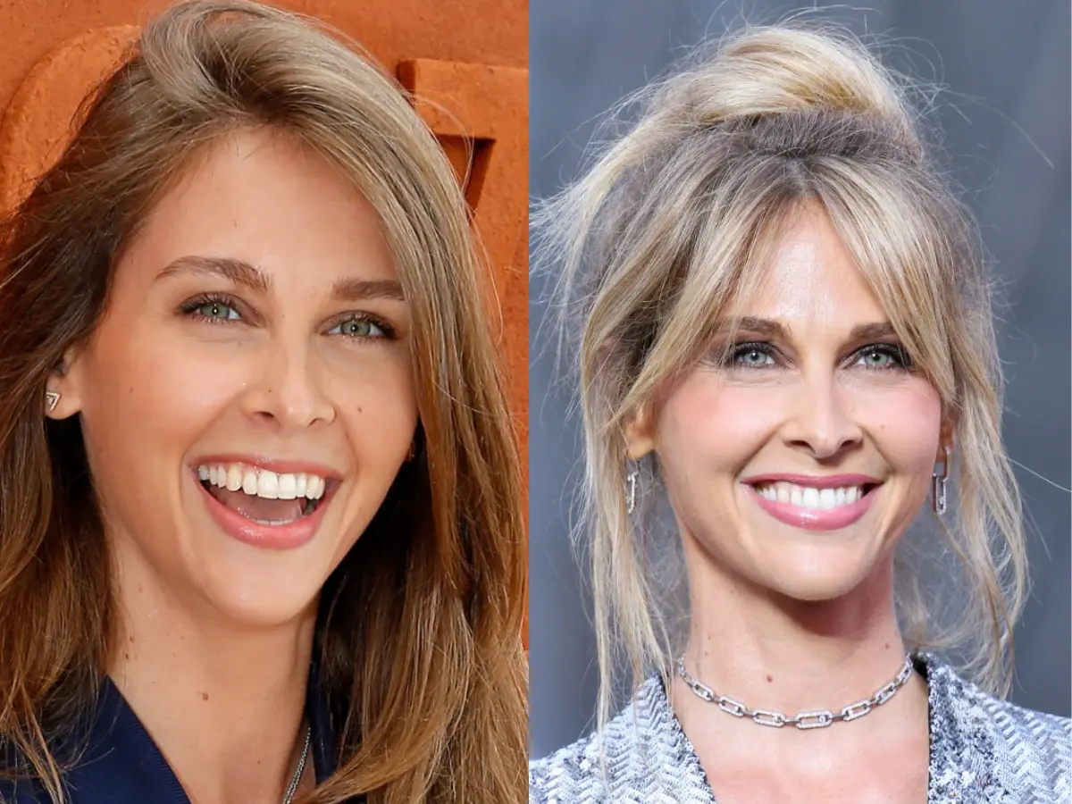 Miss France Ophélie Meunier's Teeth Transformation | LEMA