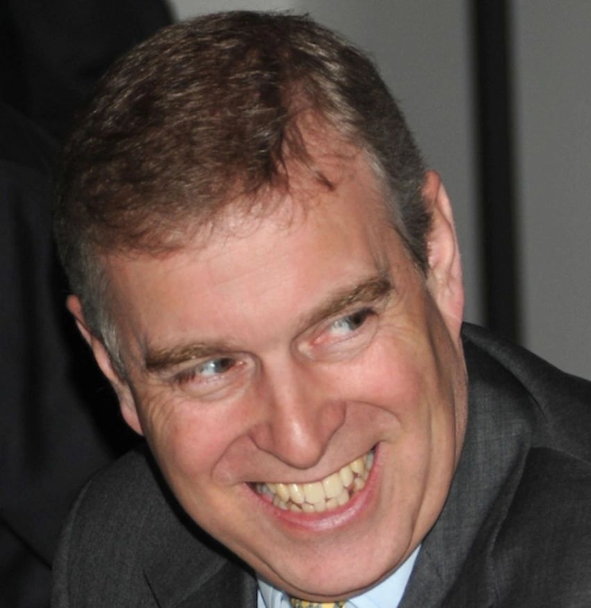 Prins Andrew zobu veselība (Vecas/Jaunas): Pirms un pēc