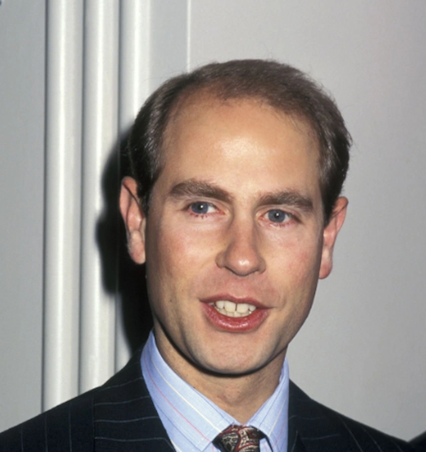 Преобразяването на зъбите на принц Едуърд