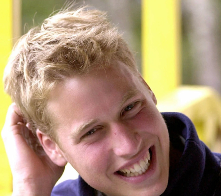 Tannene til prins William (Gamle/Nye): Før og Etter