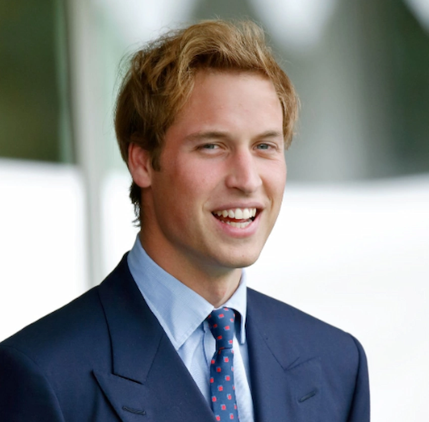 Tannene til prins William (Gamle/Nye): Før og Etter