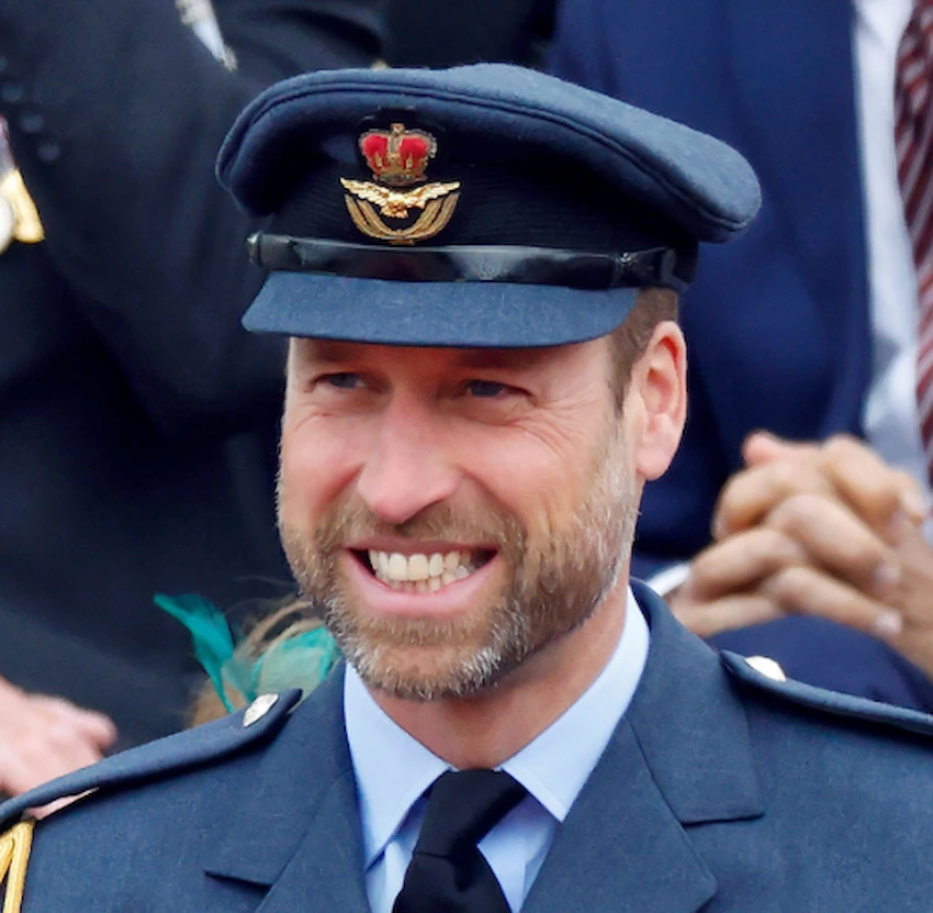 Tannene til prins William (Gamle/Nye): Før og Etter