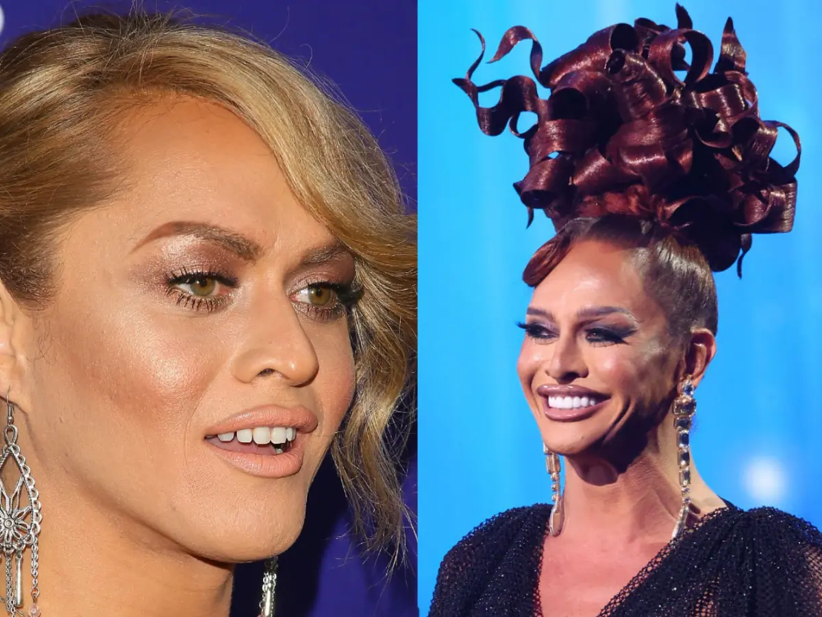 Nuevos dientes de Sasha Colby: Antes y Después | Lema Dental Clinic