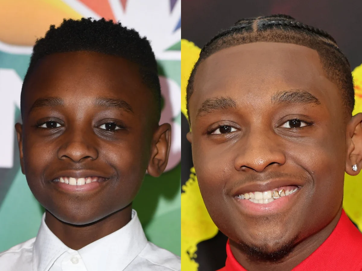 Miles Caton’s Teeth Transformation - Before and After | LEMA