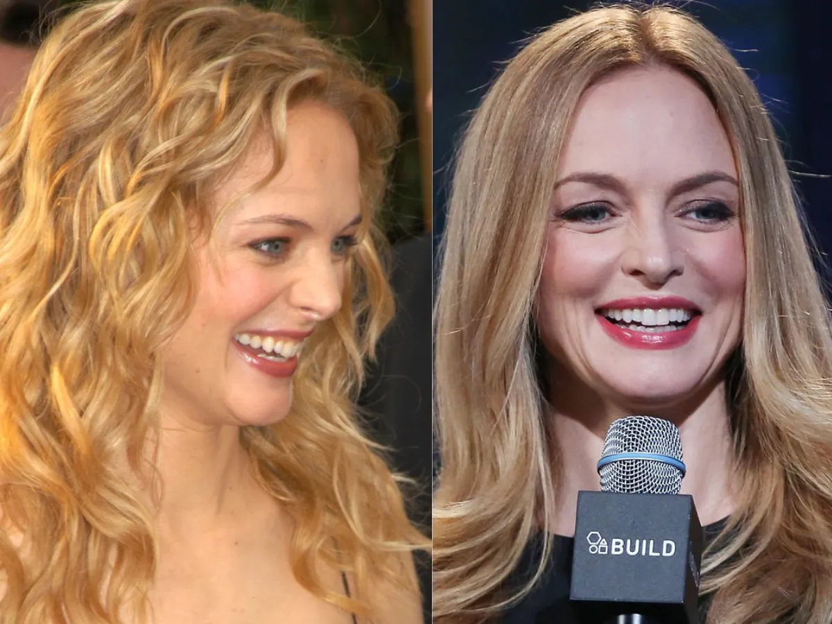 Heather Graham’s Smile Transformation: From 2006 to 2025 | LEMA