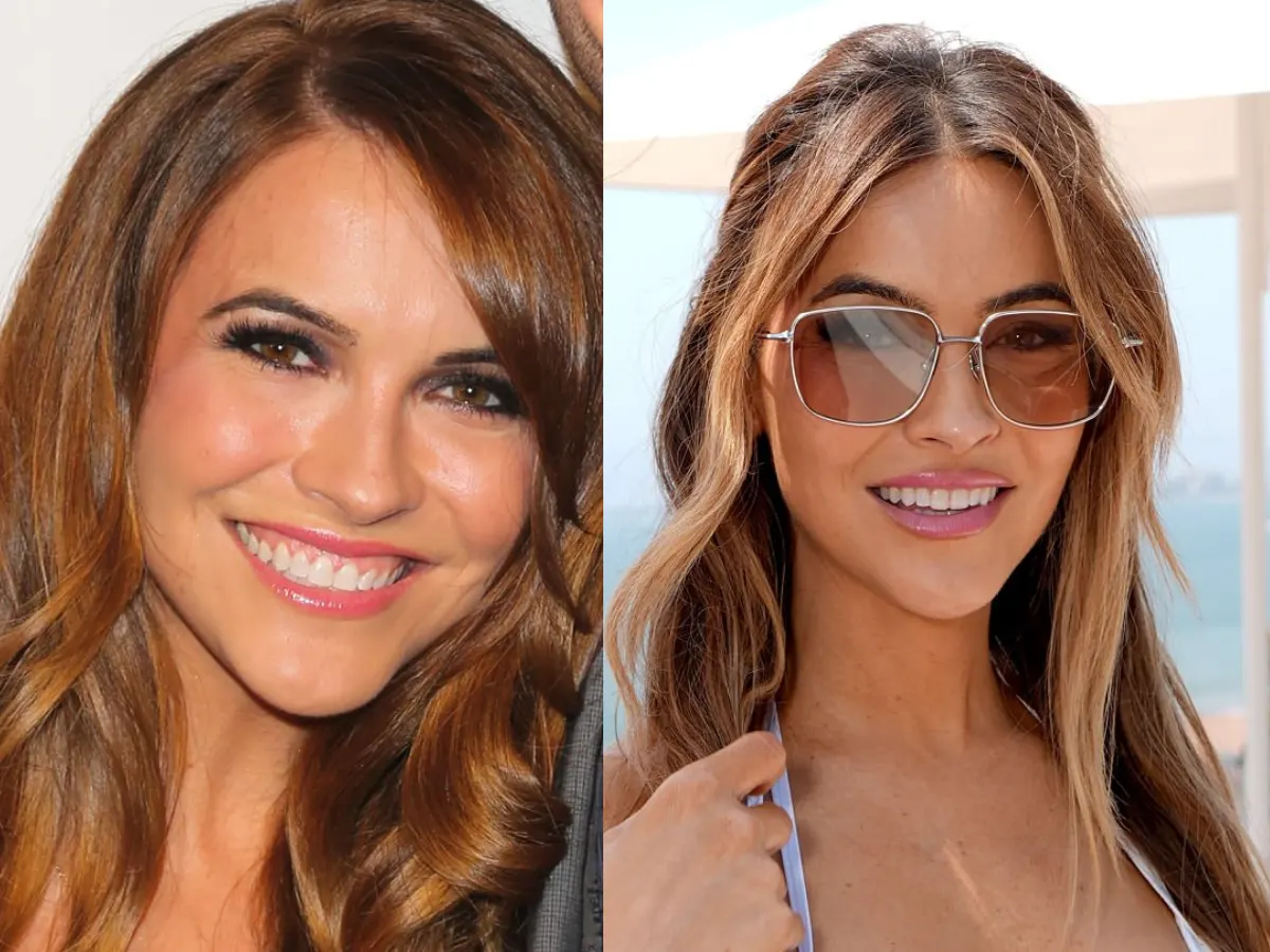 Chrishell Stause’s Smile Evolution: Before - After | LEMA