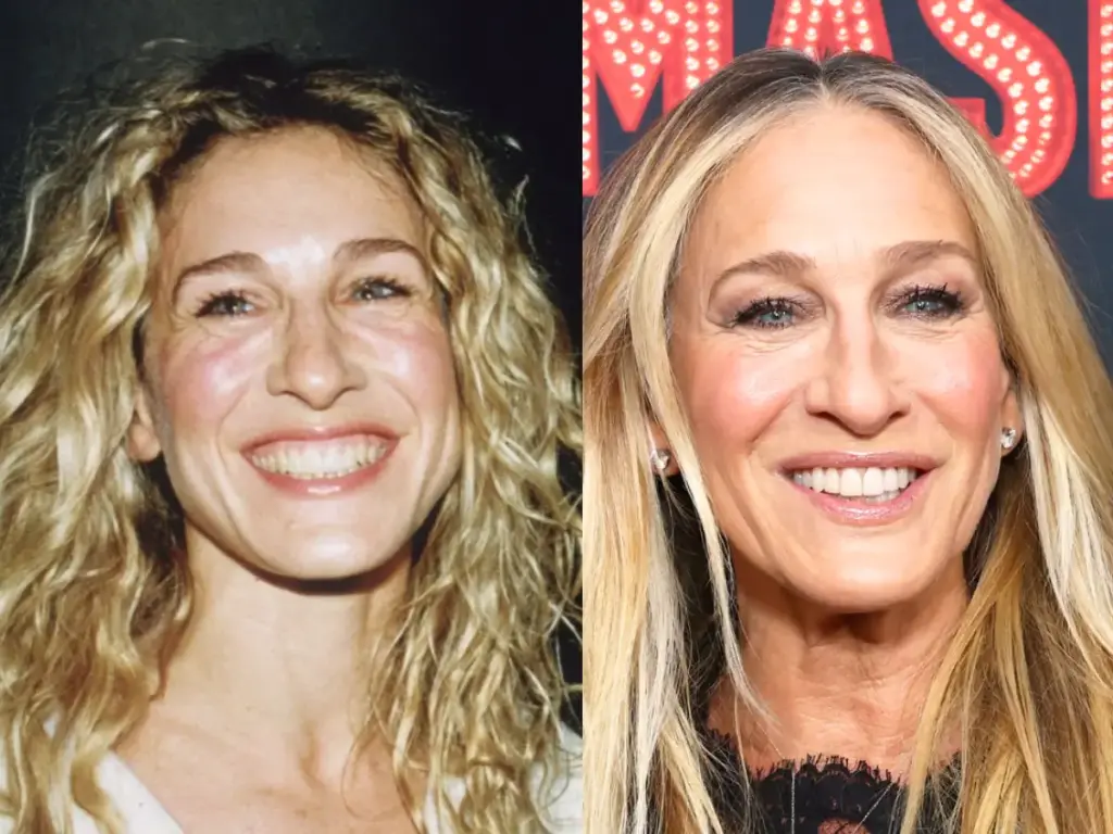 Sarah Jessica Parker Young vs Now: Her Smile Transformation | LEMA