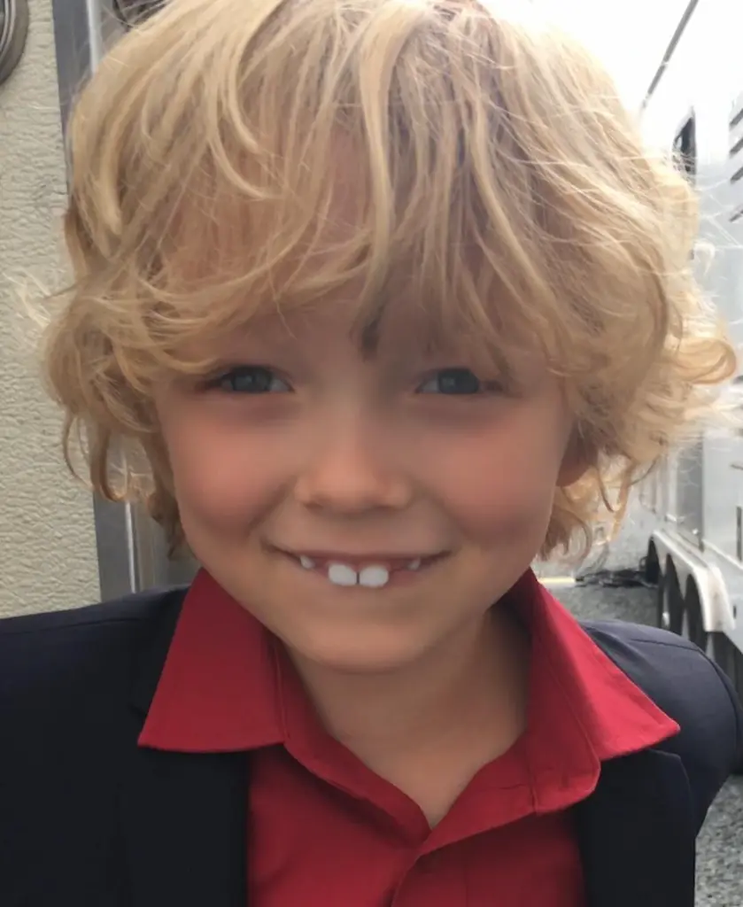 Tanden van Christian Converri (oud/nieuw): vóór en na