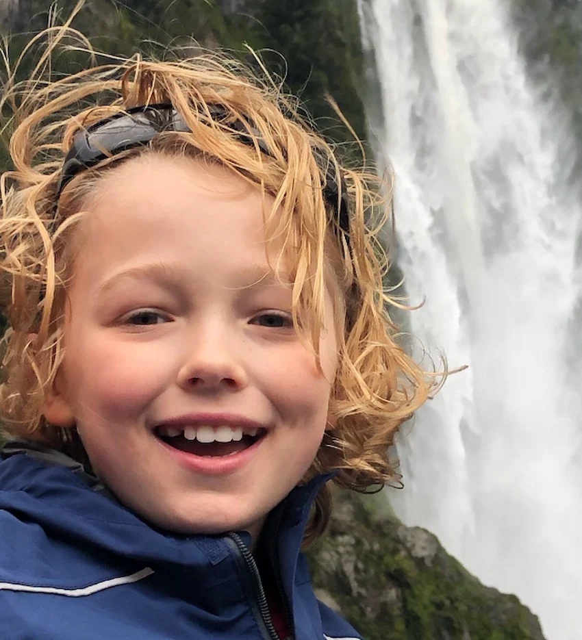 Tanden van Christian Converri (oud/nieuw): vóór en na