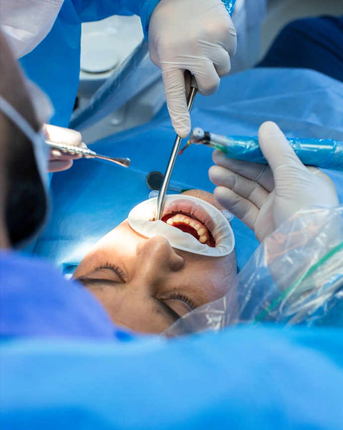 D7922 Dental Code: Guidance for Safe Foreign Body Removal | LEMA