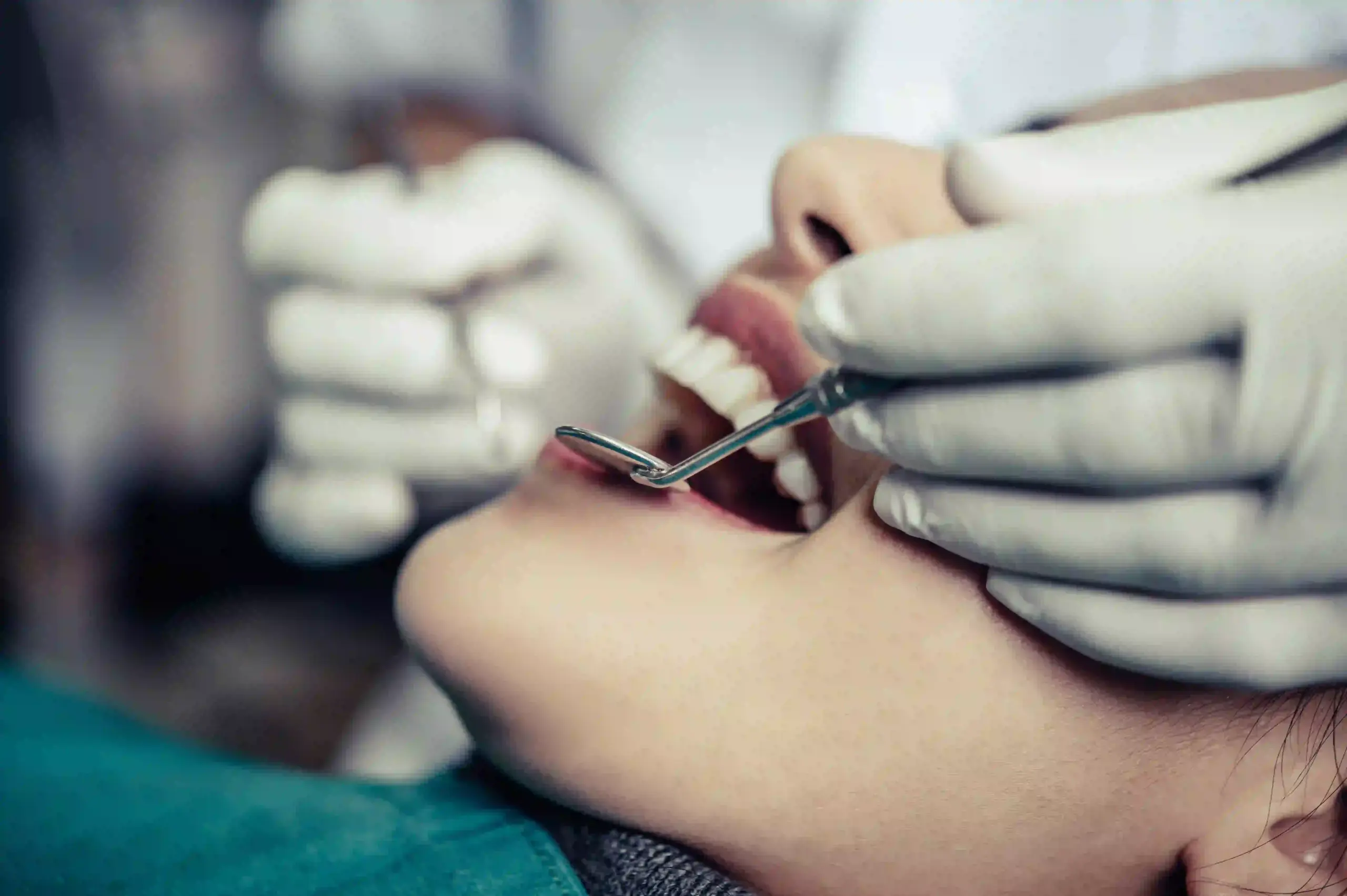 Dental Code D7210: Surgical Extraction of a Fully Erupted Tooth | LEMA