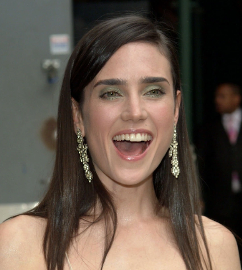 Que s'est-il passé avec les dents de Jennifer Connelly | Lema Dental Clinic