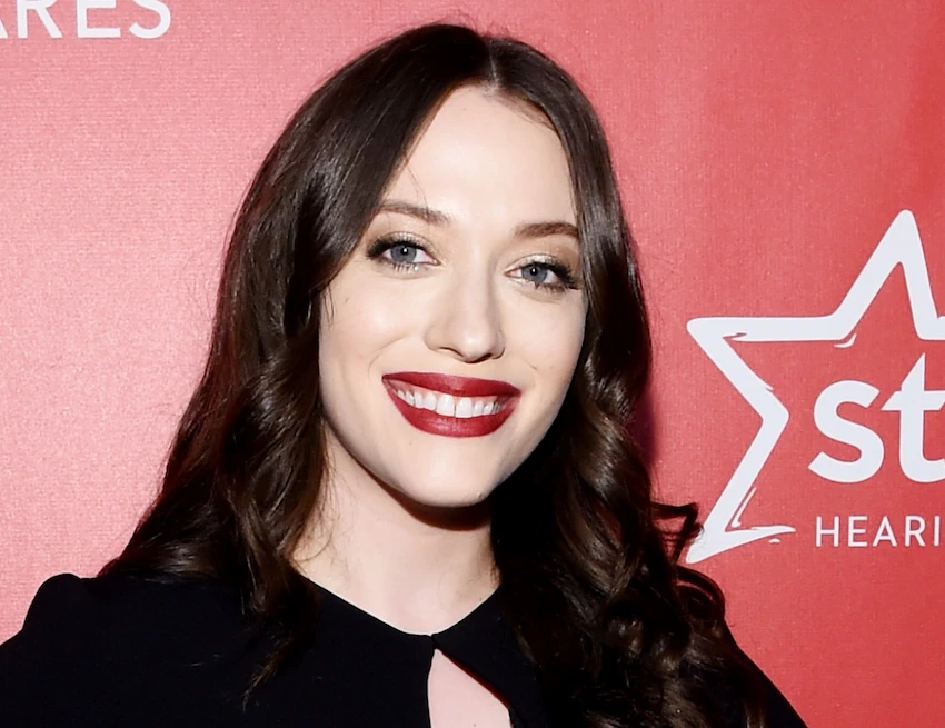 La sonrisa de Kat Dennings: ¿Se pueden los dientes con diastema