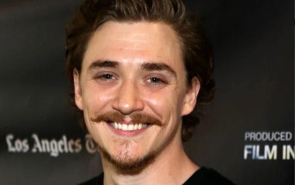 Die Smile-Entwicklung von Kyle Gallner | Lema Dental Clinic
