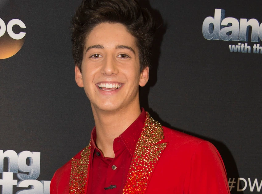 Milo Manheim's Teeth Evolution: Before and After | LEMA