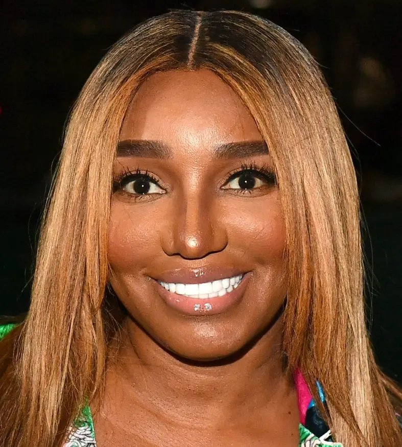 How NeNe Leakes Achieved Her Iconic Smile with Veneers? | LEMA