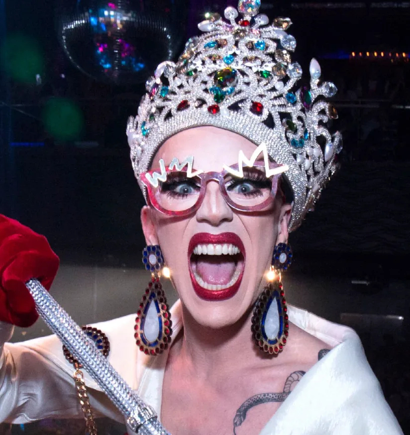 Trasformazione dei denti di Sasha Velour: Prima e Dopo | Lema Dental Clinic