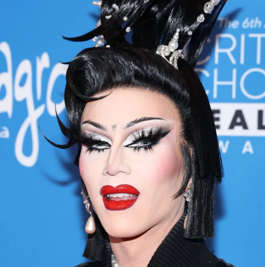 Trasformazione dei denti di Sasha Velour: Prima e Dopo | Lema Dental Clinic