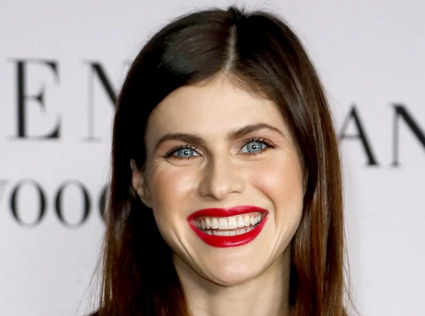 Alexandra Daddario's Smile: Veneers, Whitening, and More | LEMA