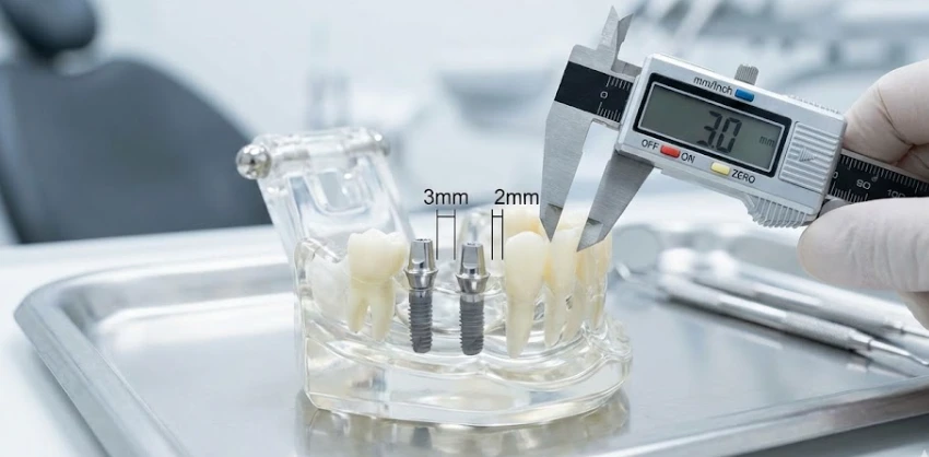 What is the 3/2 Rule for Dental Implants in Turkey? | LEMA